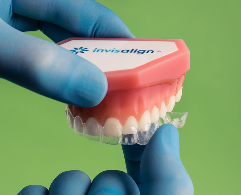 Ästhetische Zahnmedizin - Veneers, Bleaching, Zahnaufhellung, Invisalign